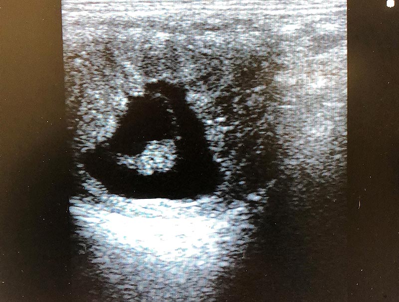 Reproductive Ultrasonography in the Mare | Equine Reproduction Concepts Reproductive Ultrasonography in the Mare | Equine Reproduction Concepts